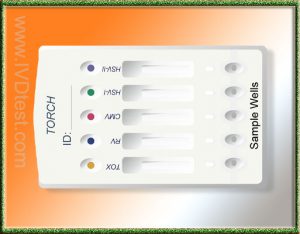 TORCH IgM and TORCH IgG Screening Tests – Ivd Rapid Tests